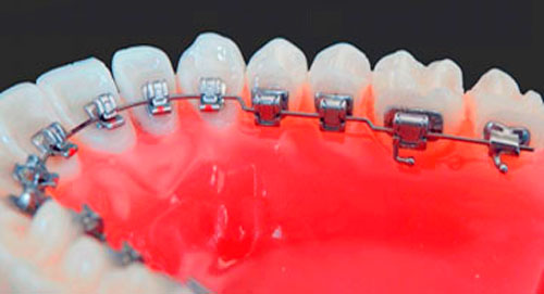 Ortodoncia - Servicios, planes y tarifas de ortodoncia - Precios ...